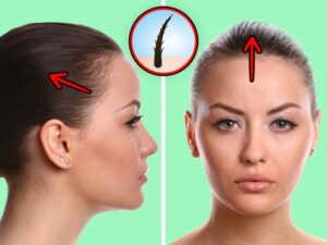 What Happens to Your Hair When You Wear Ponytails Too Often? - CreativeSide